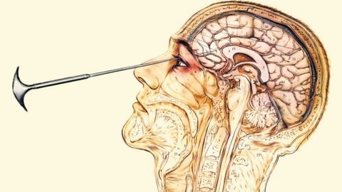 Universal Script 📌 | Universal Lobotomy Script — Roblox Scripts | ScriptBlox